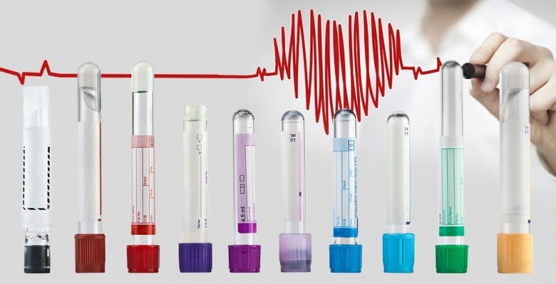 How to Read a Diabetes Lab Report | ADW Diabetes